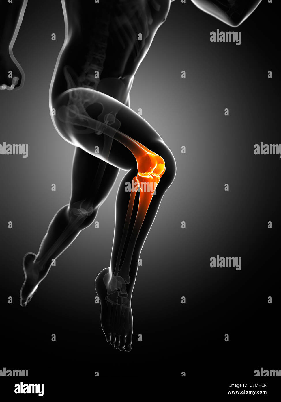 Knee pain, conceptual artwork Stock Photo - Alamy