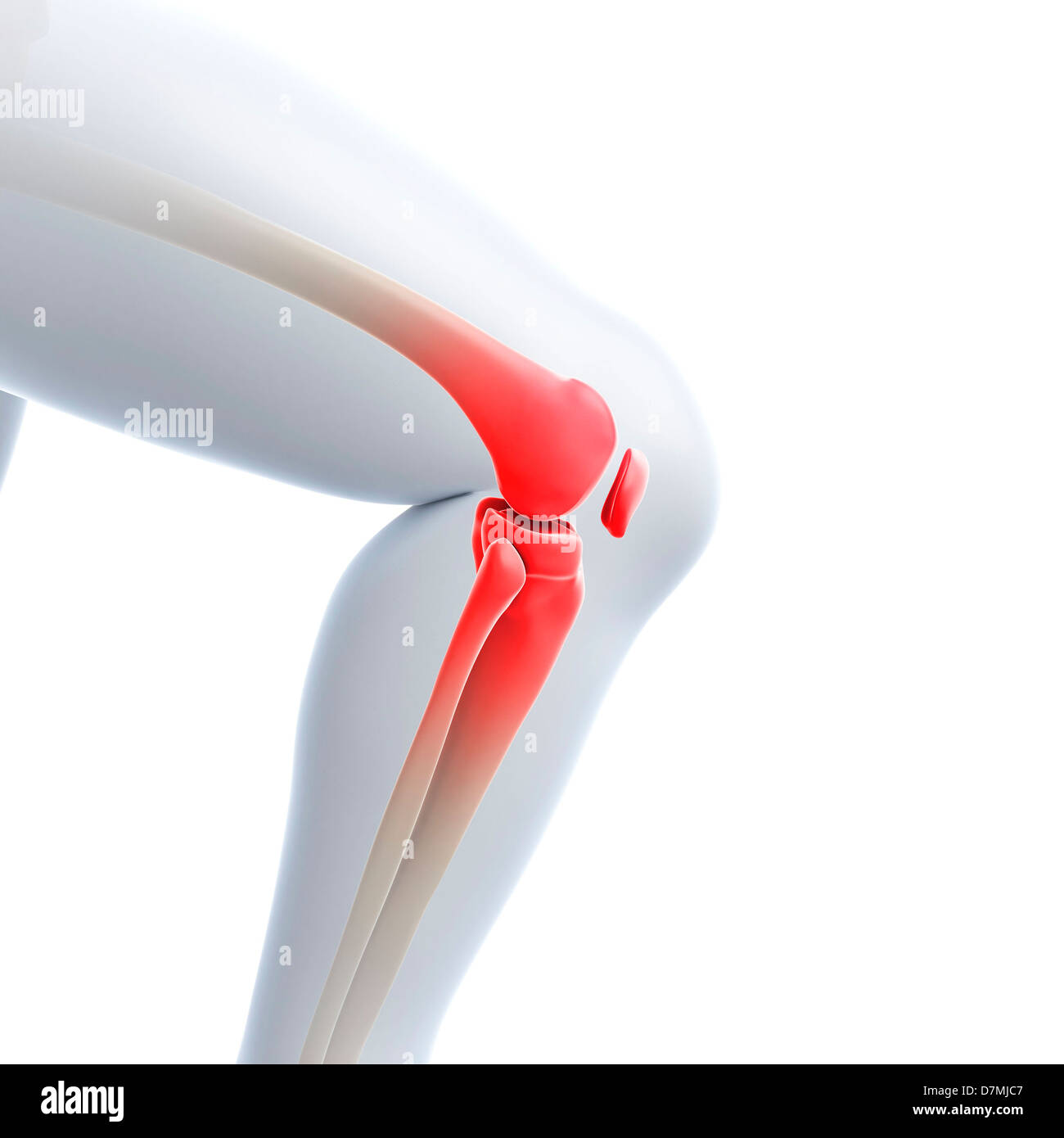 Knee pain, conceptual artwork Stock Photo - Alamy