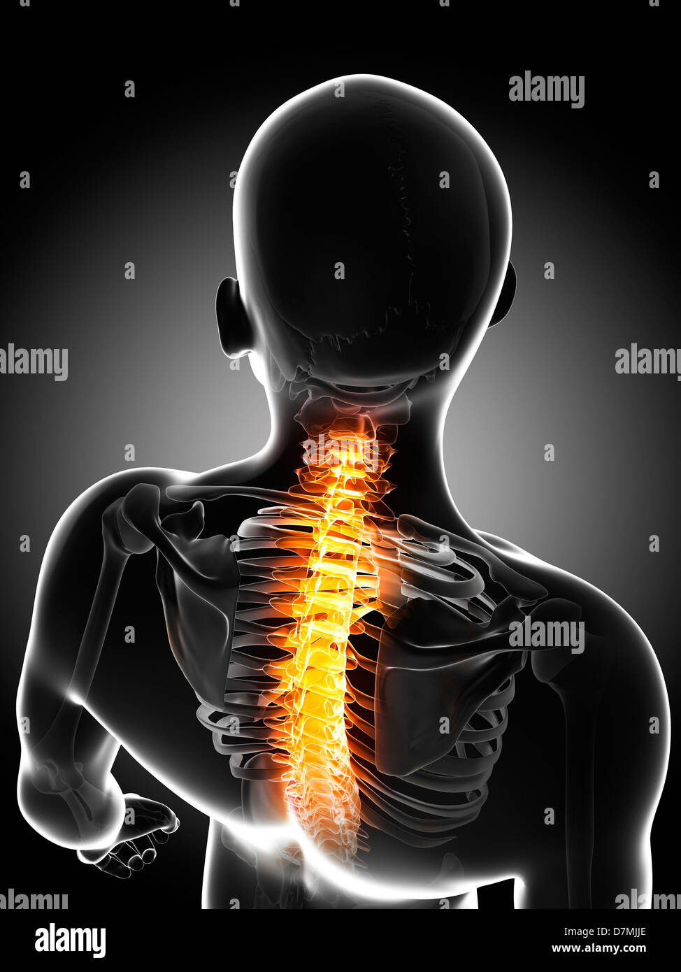 Back pain, conceptual artwork Stock Photo - Alamy