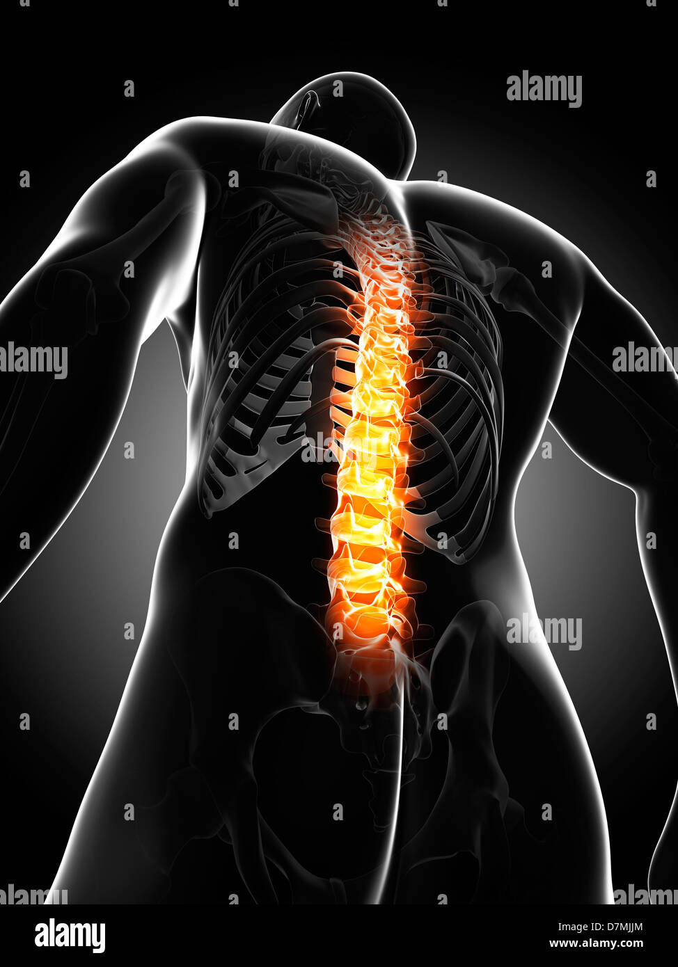 Back pain, conceptual artwork Stock Photo - Alamy