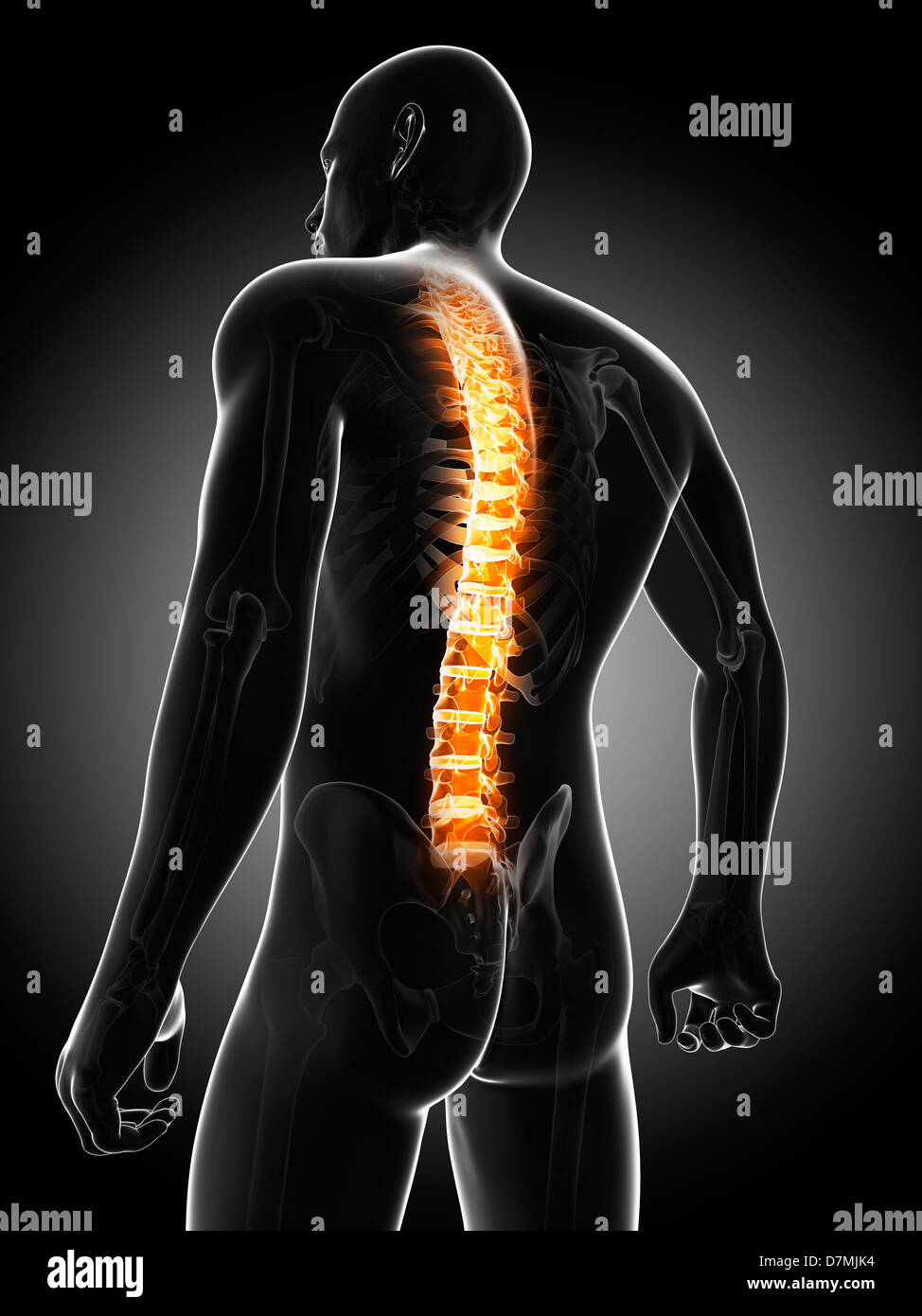 Back pain, conceptual artwork Stock Photo - Alamy