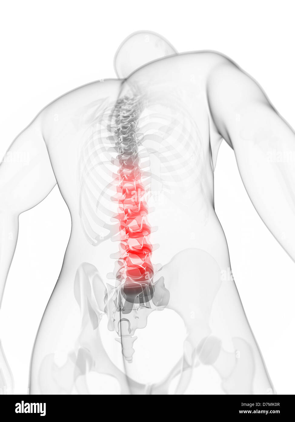 Lower back pain illustration hi-res stock photography and images - Alamy
