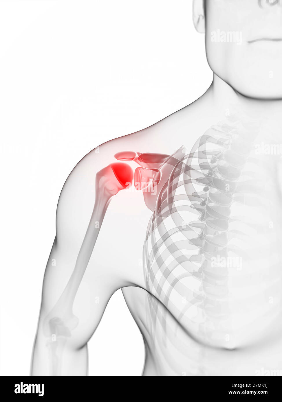 Humerus pain hi-res stock photography and images - Alamy