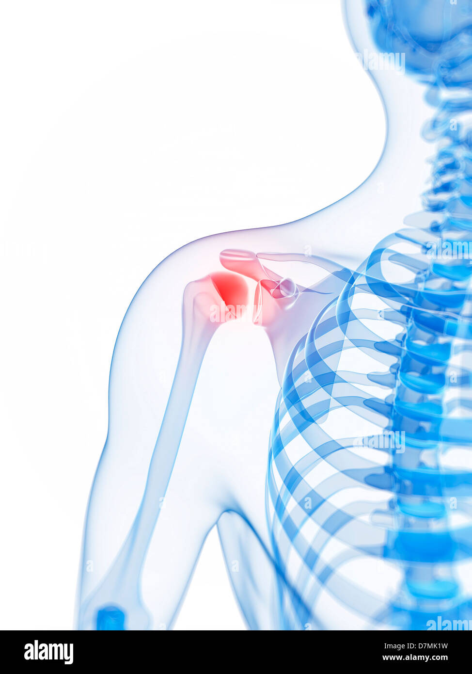 Humerus pain hi-res stock photography and images - Alamy