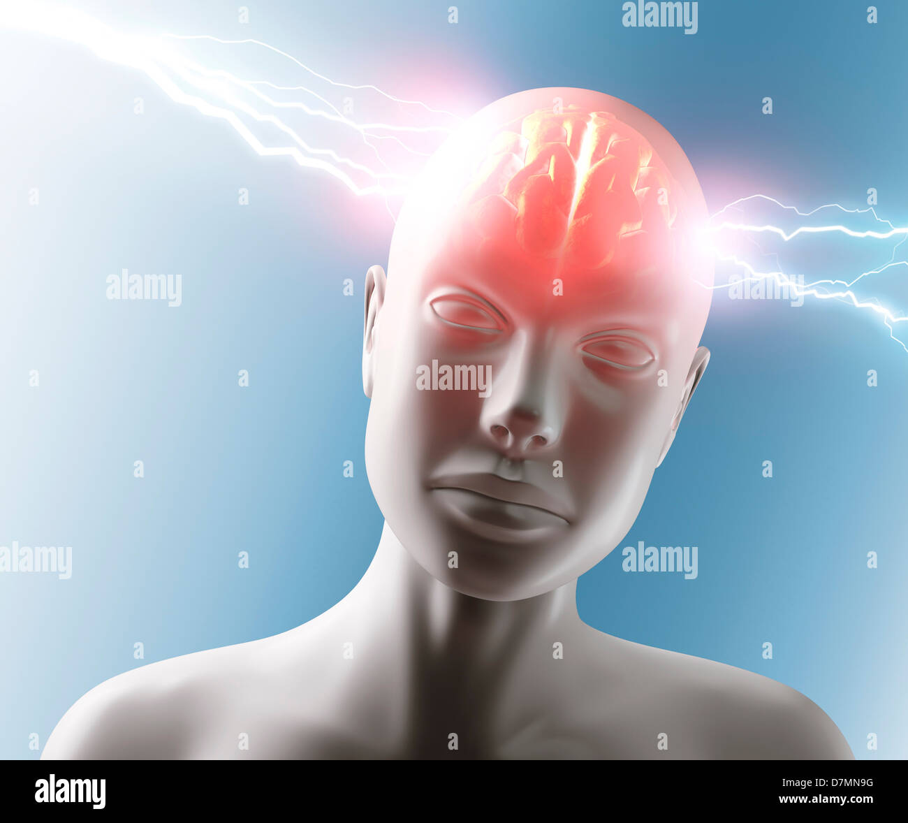 Headache, conceptual artwork Stock Photo - Alamy