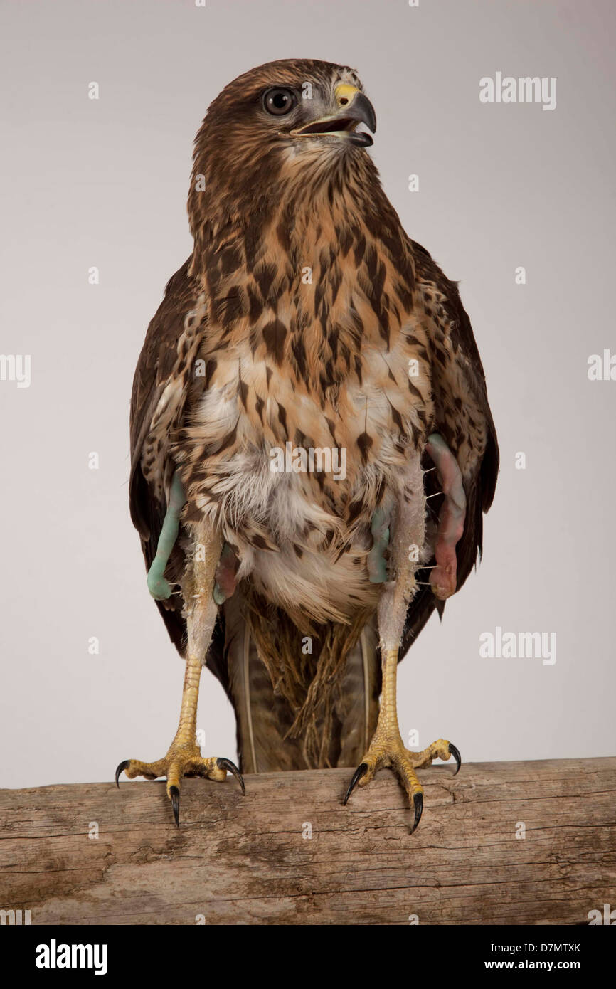 External fixators hi-res stock photography and images - Alamy