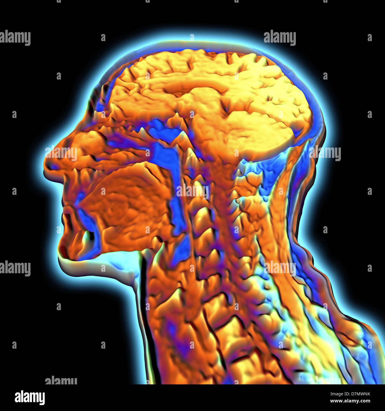 Human Brain Scan Mri Not Health High Resolution Stock Photography and ...
