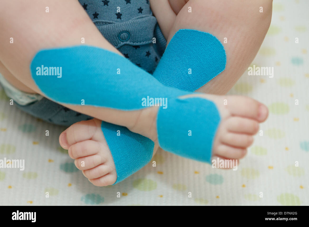 Kinesio tape on baby boy legs Stock Photo - Alamy