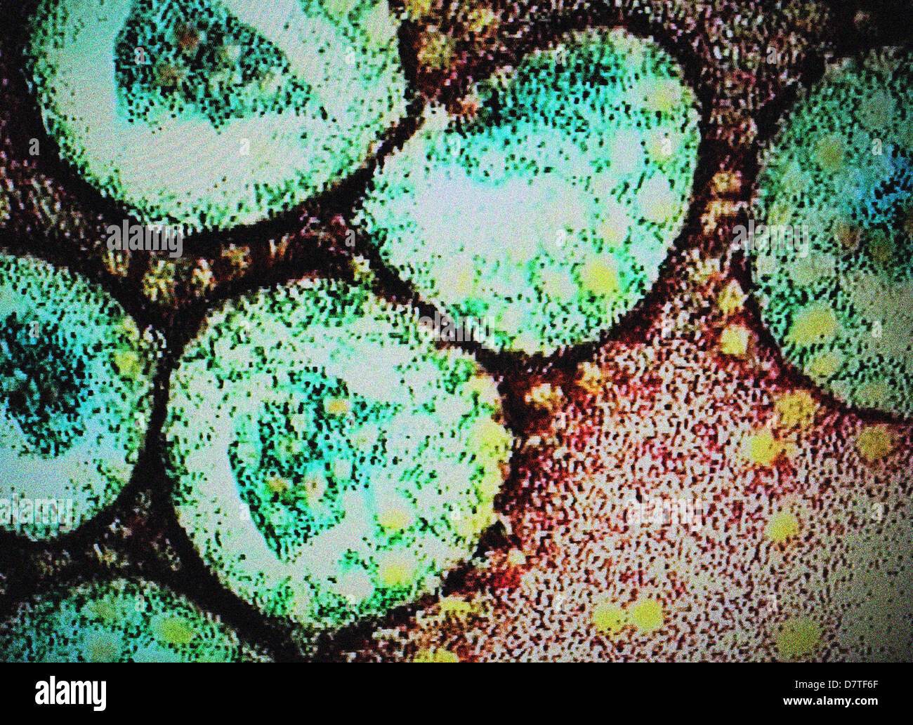 The newly discovered Coronavirus - a pathogen related to the SARS virus ...