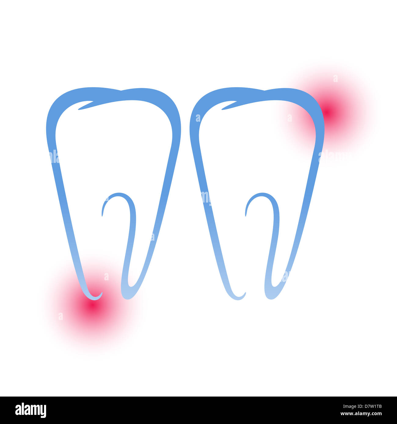 Sick teeth isolated on a white background Stock Photo - Alamy