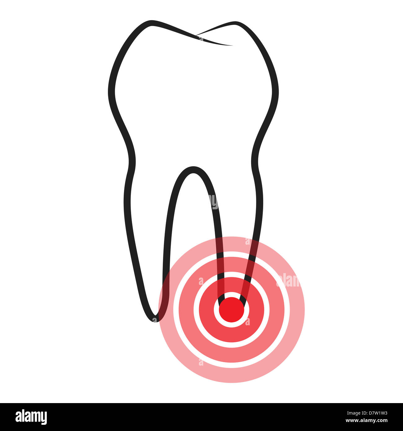 Sick tooth isolated on a white background Stock Photo - Alamy