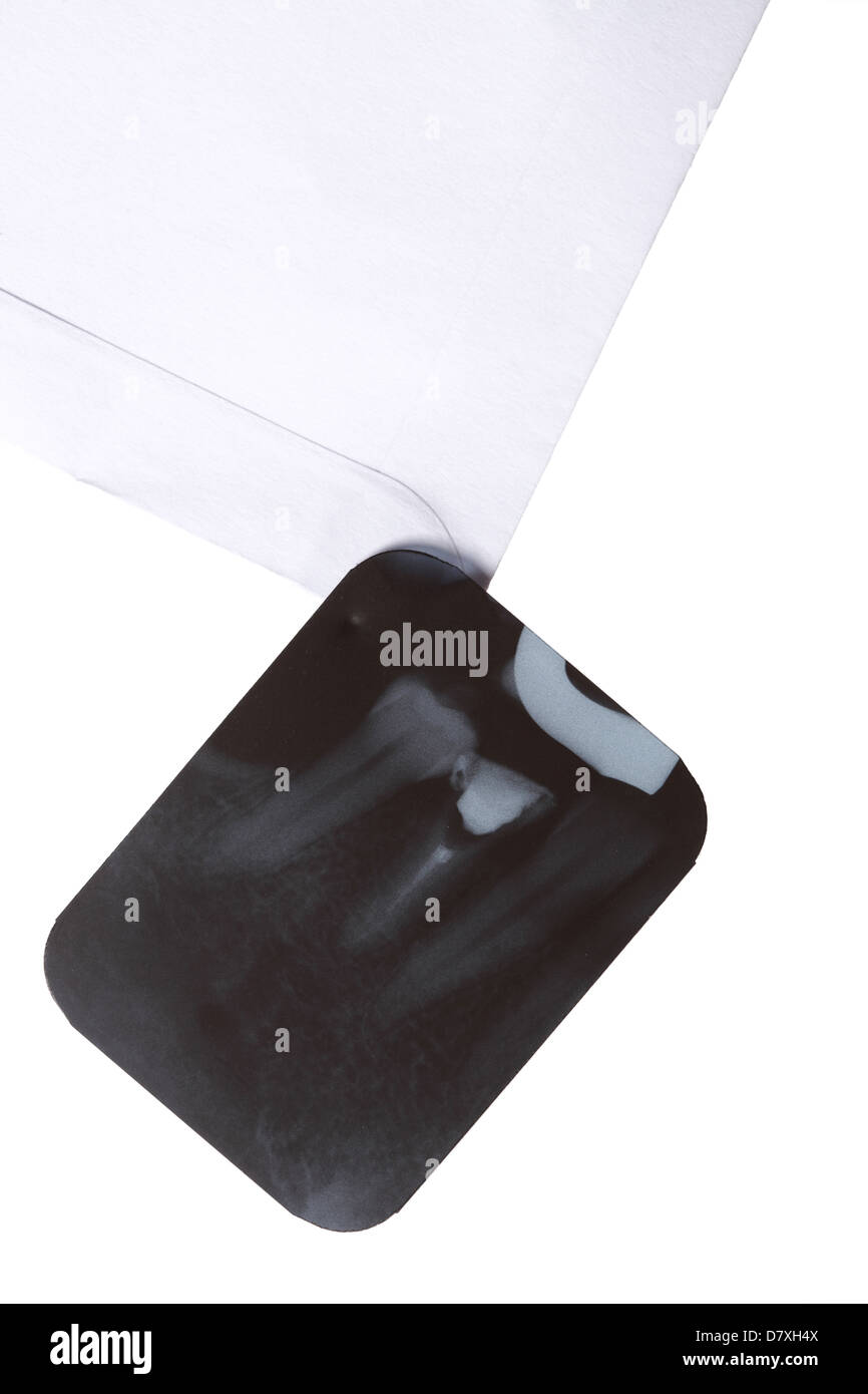 a dental x-ray film detail isolated on white Stock Photo - Alamy