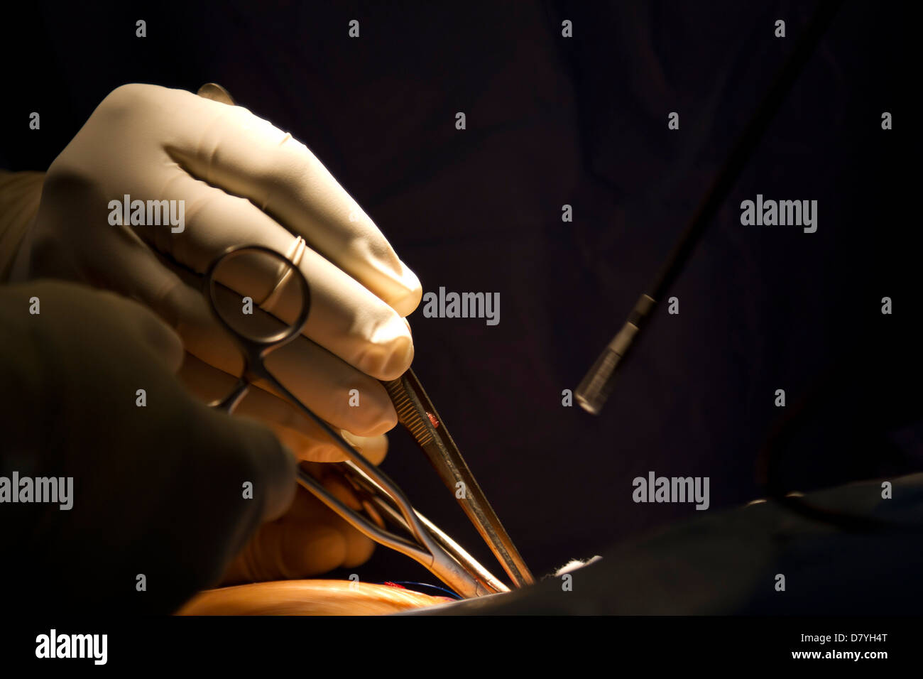 Surgical Intervention Stock Photos & Surgical Intervention Stock Images ...