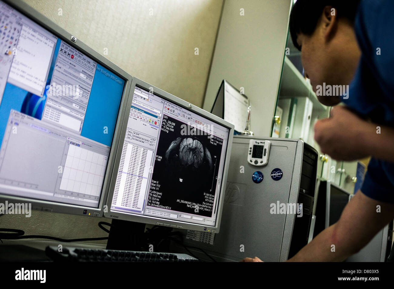 Animal brain mri hi-res stock photography and images - Alamy