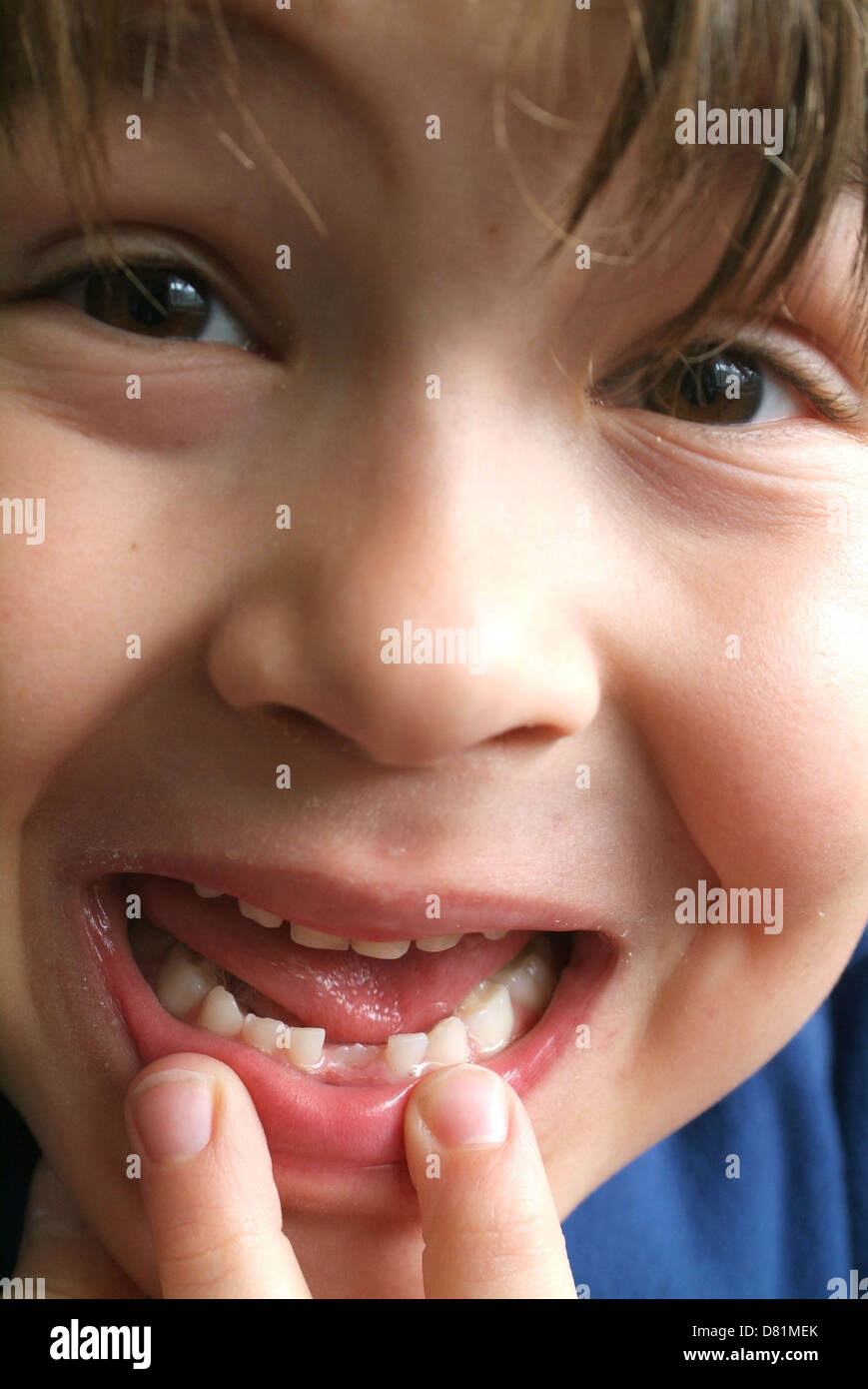 Boy with his teeth Stock Photo - Alamy