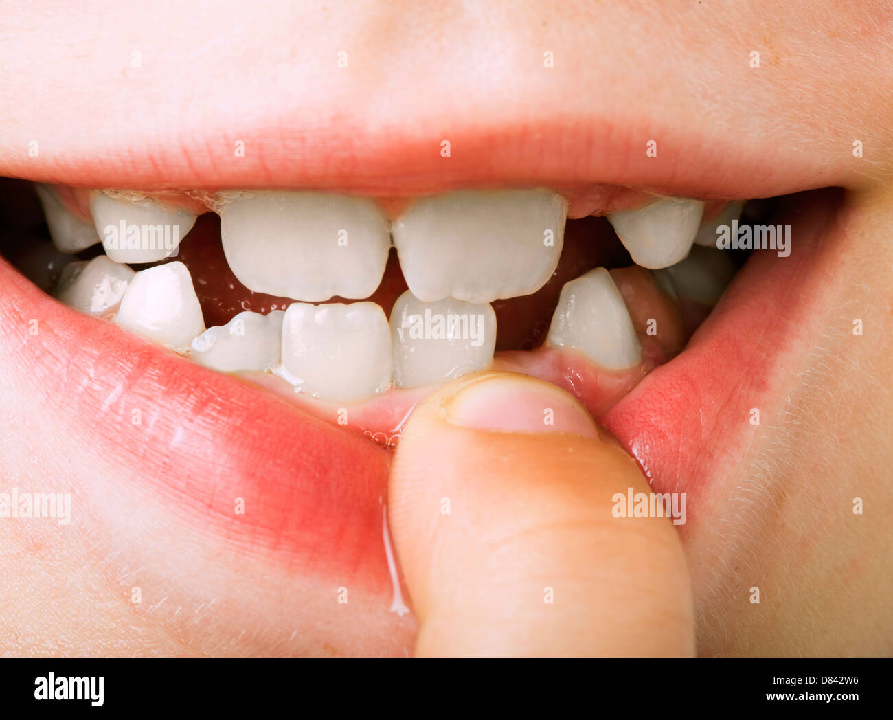 Child shows tooth. Close up studio shot Stock Photo - Alamy