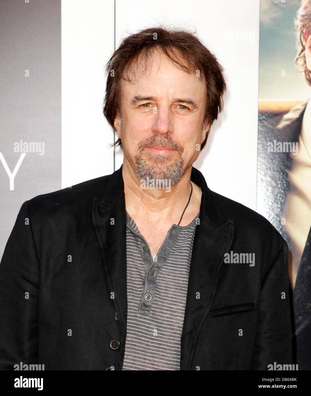 Kevin Nealon Hair Transplant
