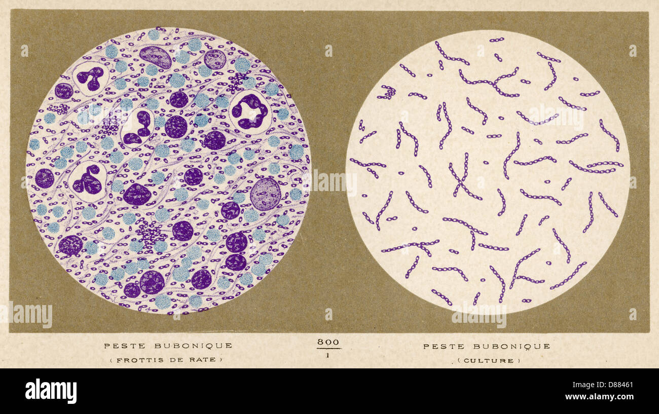 Bubonic plague hi-res stock photography and images - Alamy