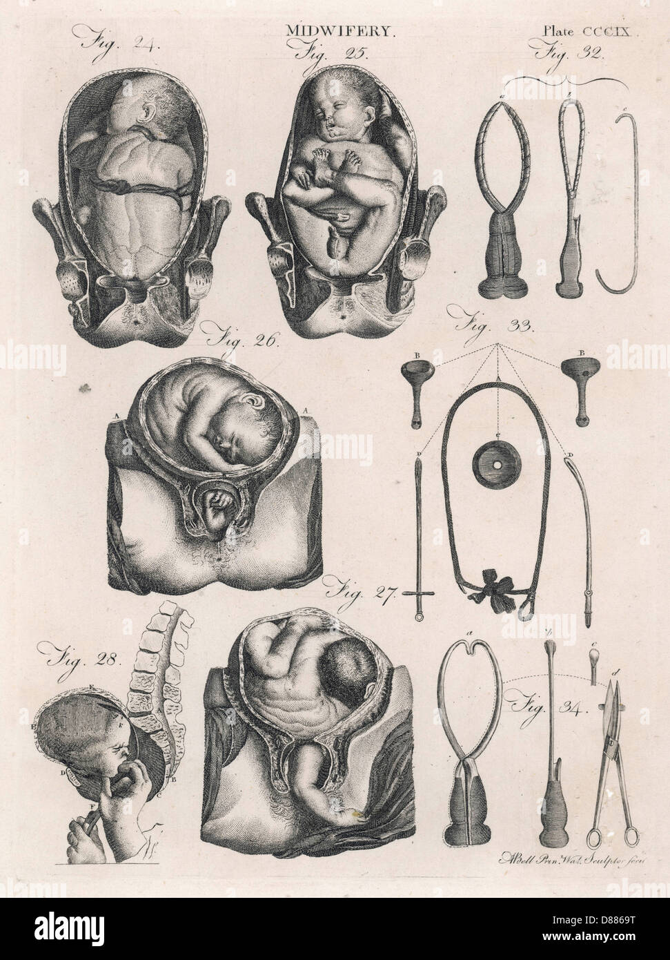 Midwifery instruments hi-res stock photography and images - Alamy
