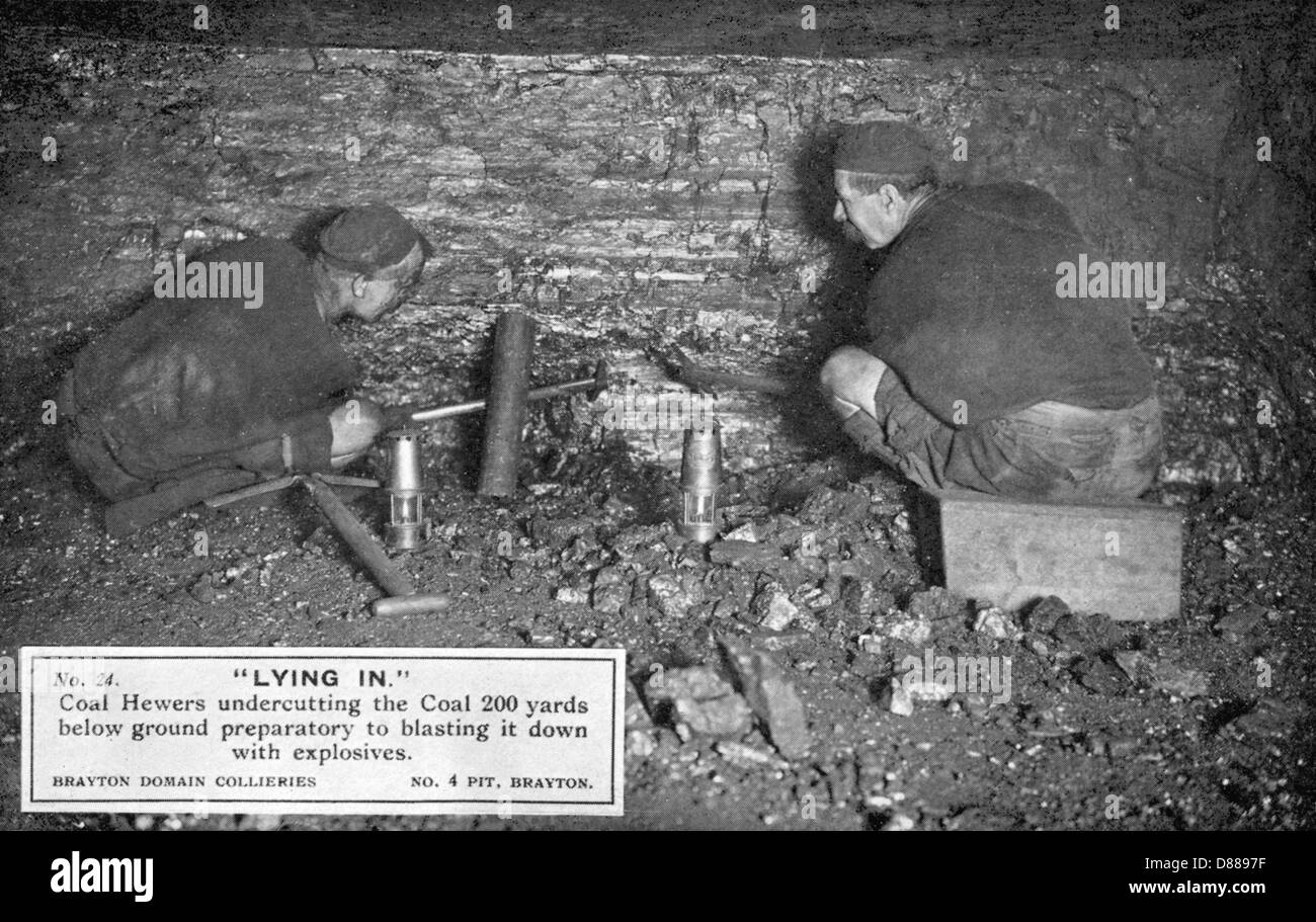 Side of the face Black and White Stock Photos & Images - Alamy