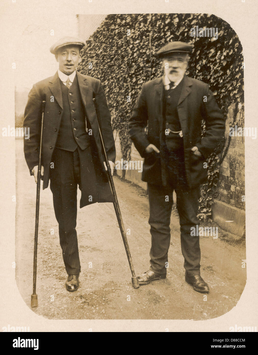 Lost Leg High Resolution Stock Photography and Images - Alamy