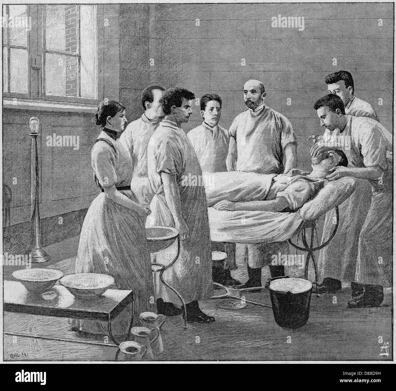 Patient under anaesthetic hi-res stock photography and images - Alamy