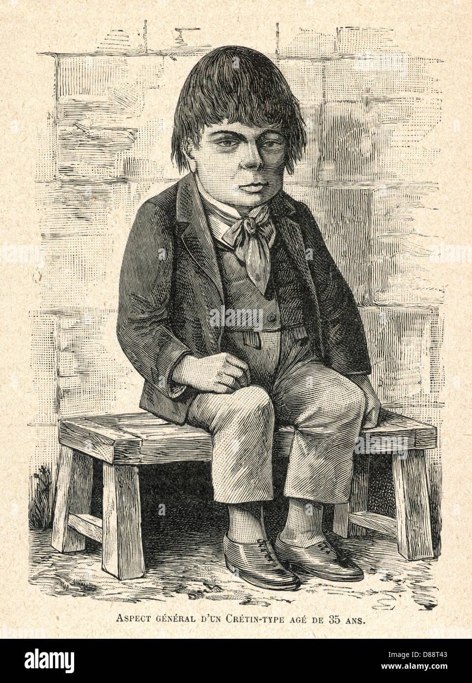 Mentally deficient man - aged 35 Stock Photo - Alamy