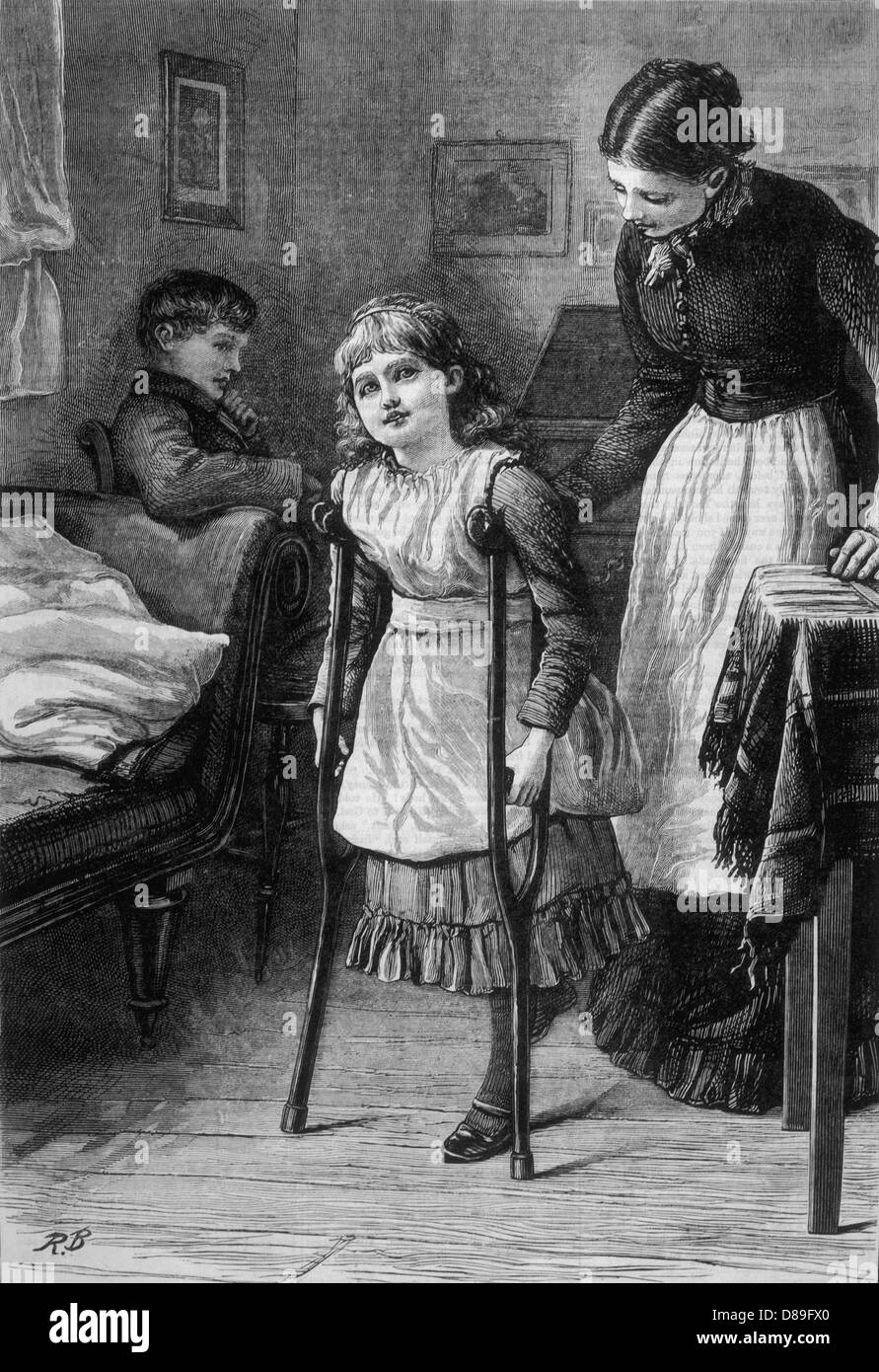 GIRL ON CRUTCHES/1882 Stock Photo - Alamy