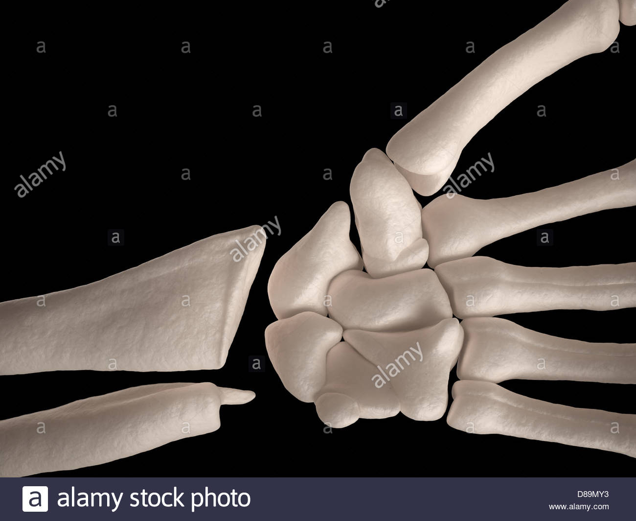 Scaphoid Bone High Resolution Stock Photography and Images - Alamy