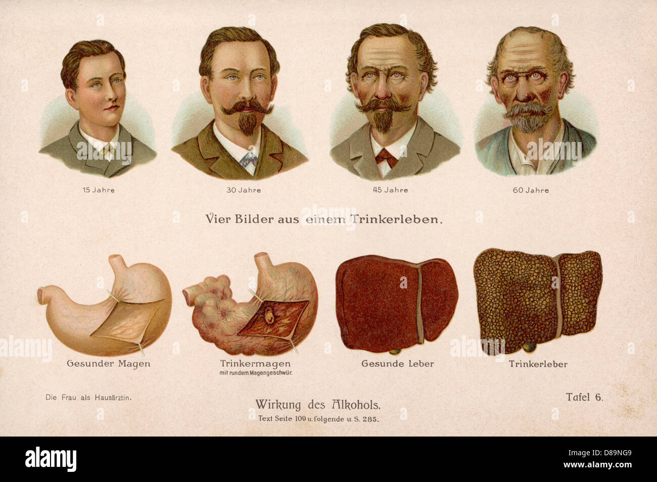 RAVAGES OF ALCOHOL Stock Photo - Alamy