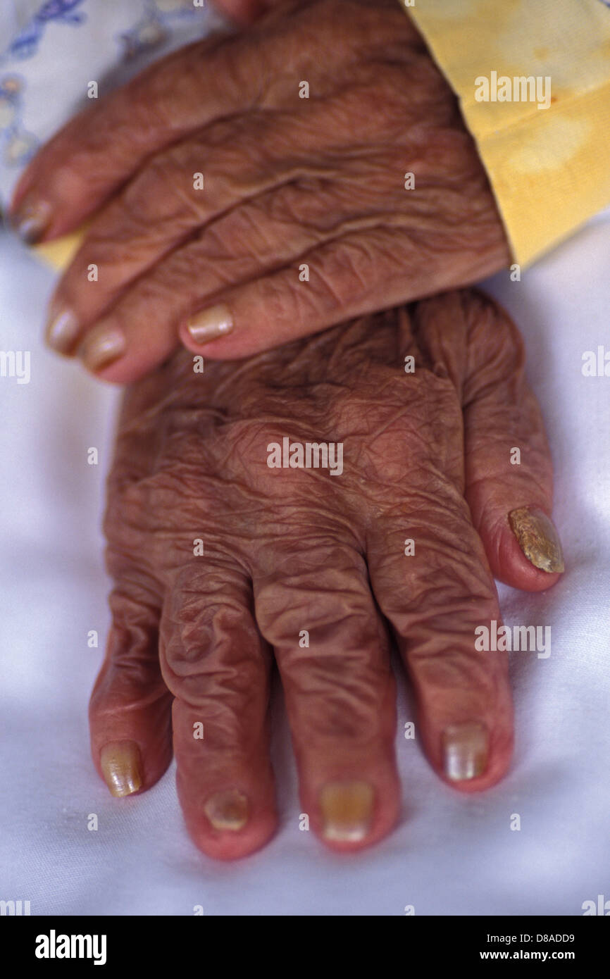 Aging. Hands of an very elderly woman Stock Photo - Alamy