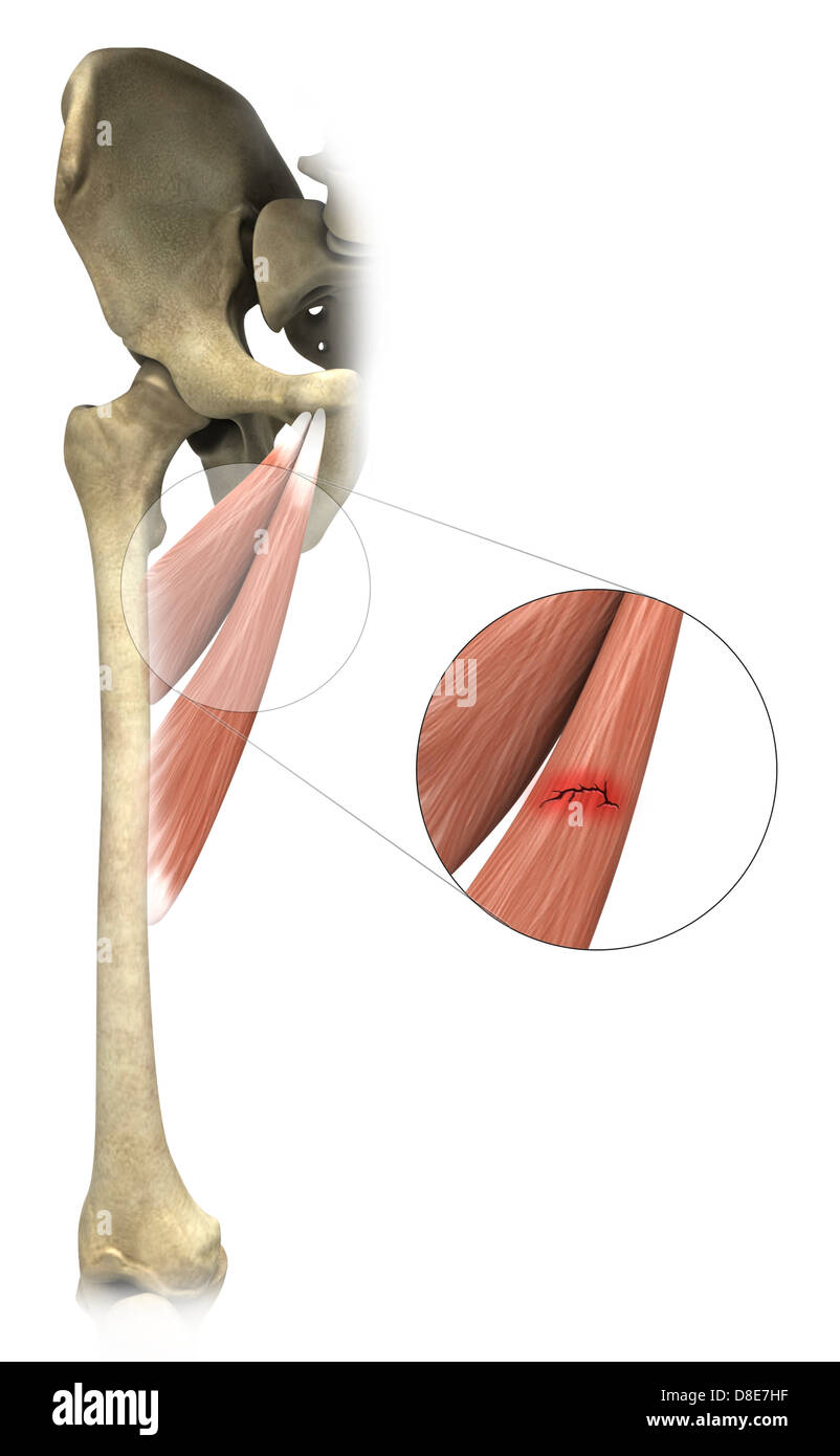 Adductor muscles hi-res stock photography and images - Alamy