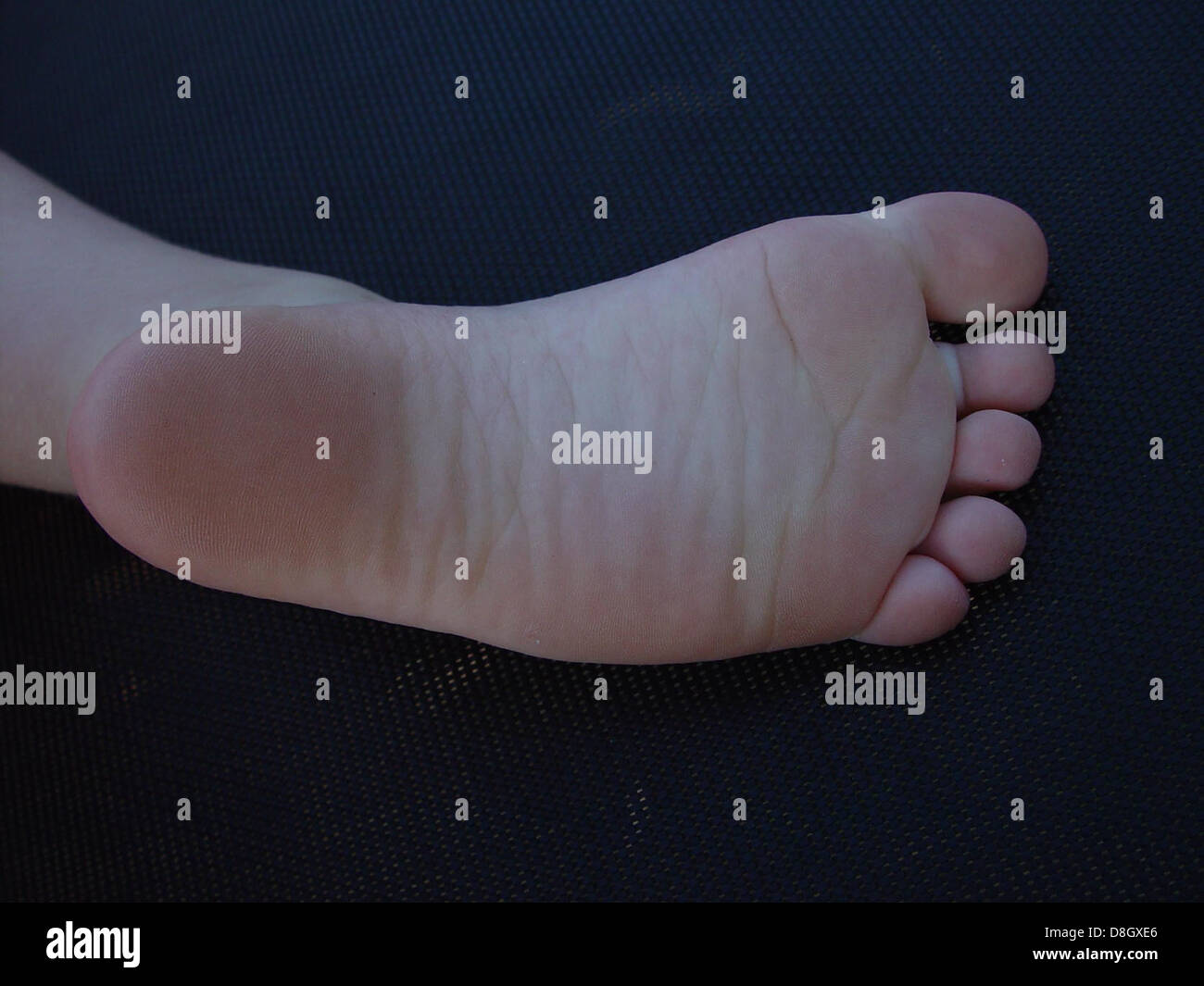 A close-up of a child's foot, showing soft skin and tiny toes. The ...