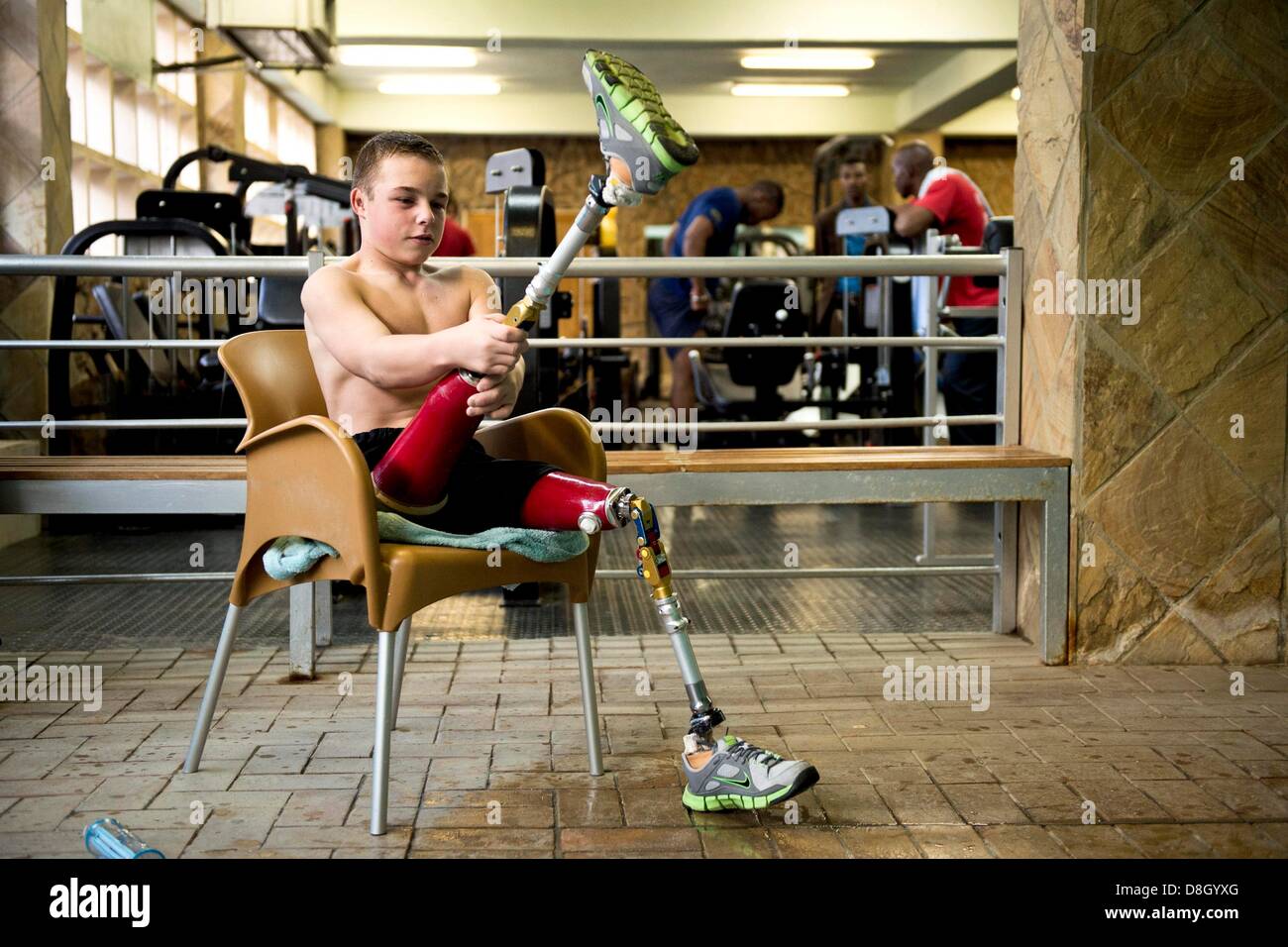 Deformed legs hi-res stock photography and images - Alamy