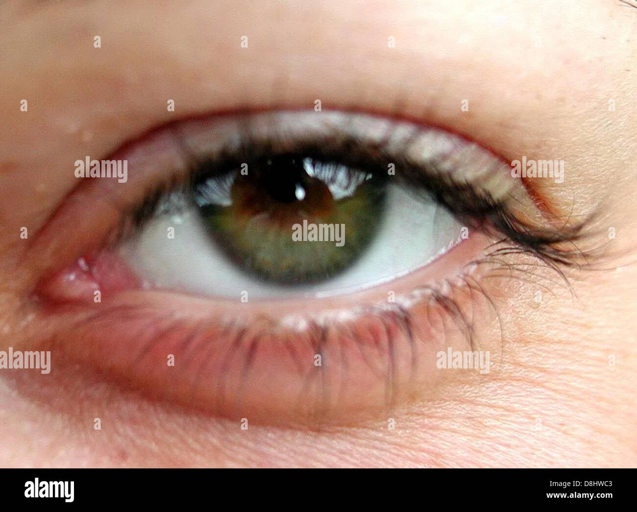 A close-up image of a human eye with its details clearly visible. The ...