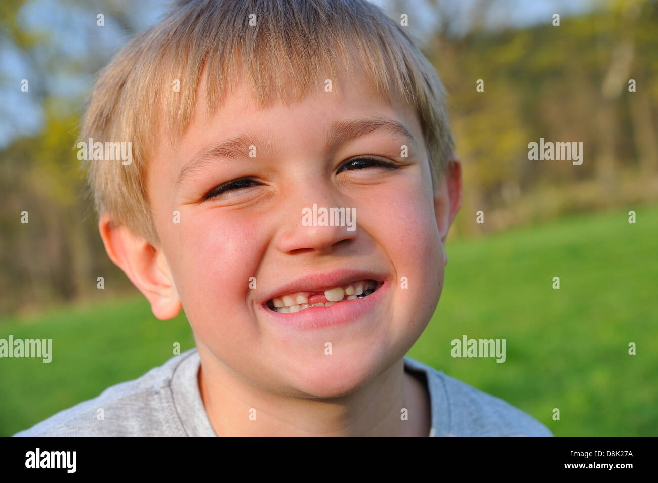 Missing teeth man hi-res stock photography and images - Alamy Missing teeth man hi-res stock photography and images - Alamy