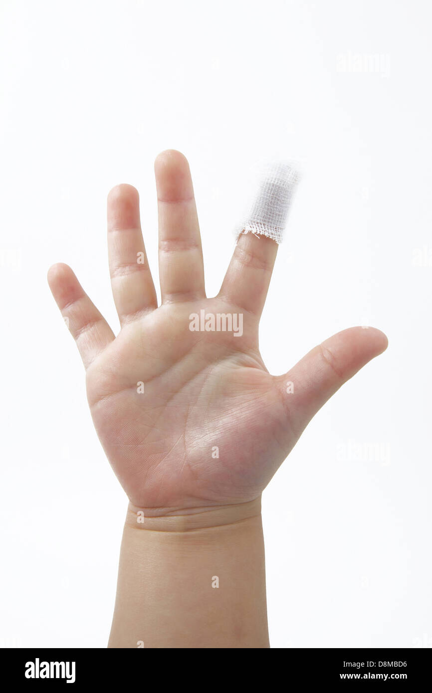 Finger accident hi-res stock photography and images - Alamy