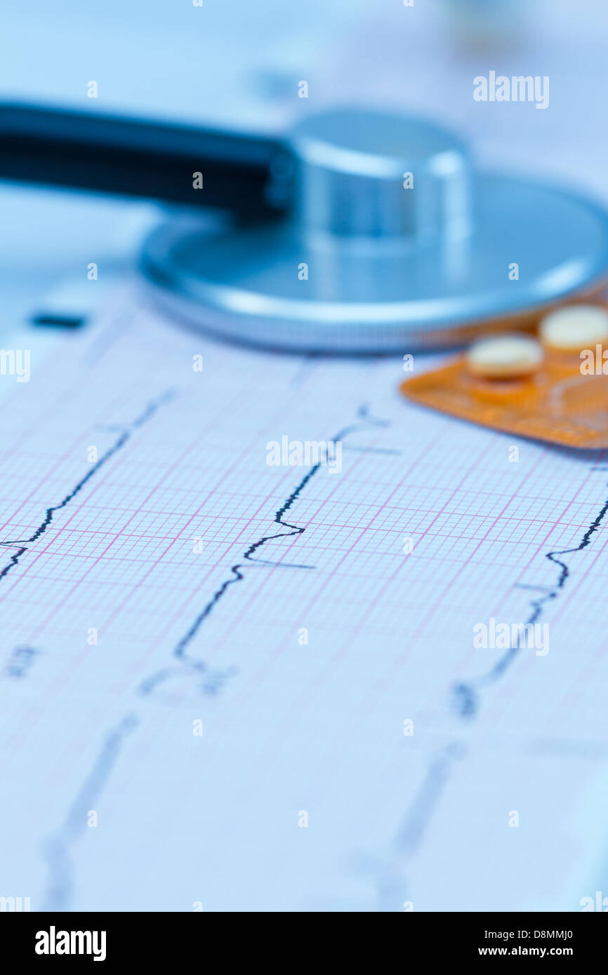Cardiogram with stethoscope Stock Photo - Alamy