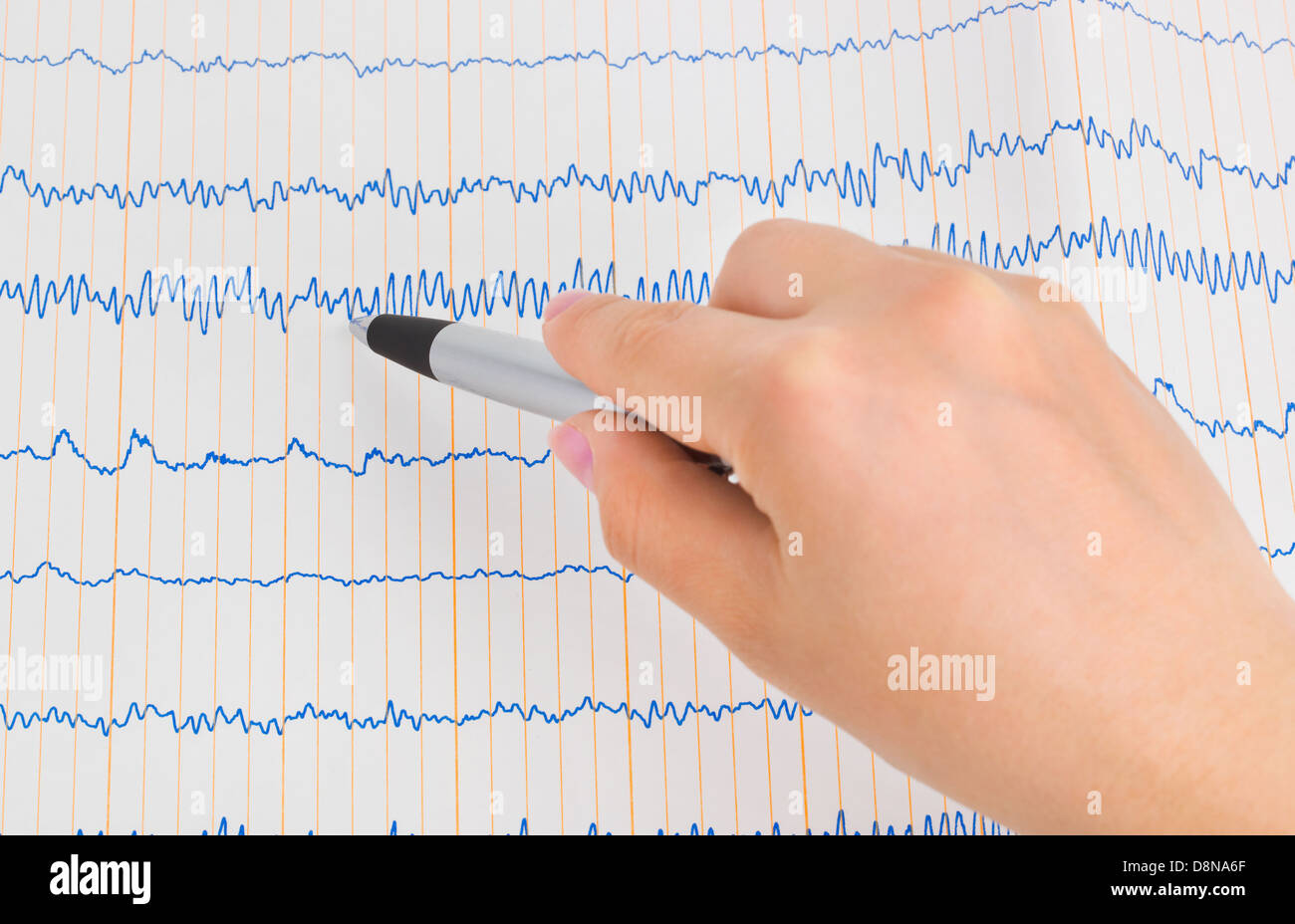 Ecg woman hi-res stock photography and images - Alamy