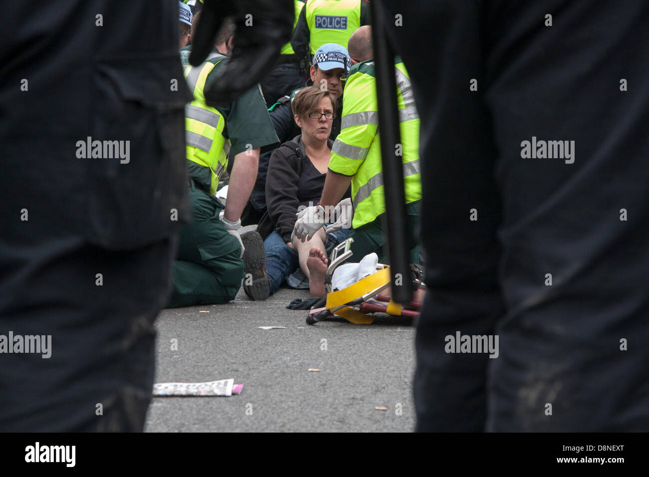 Leg injuries hi-res stock photography and images - Alamy