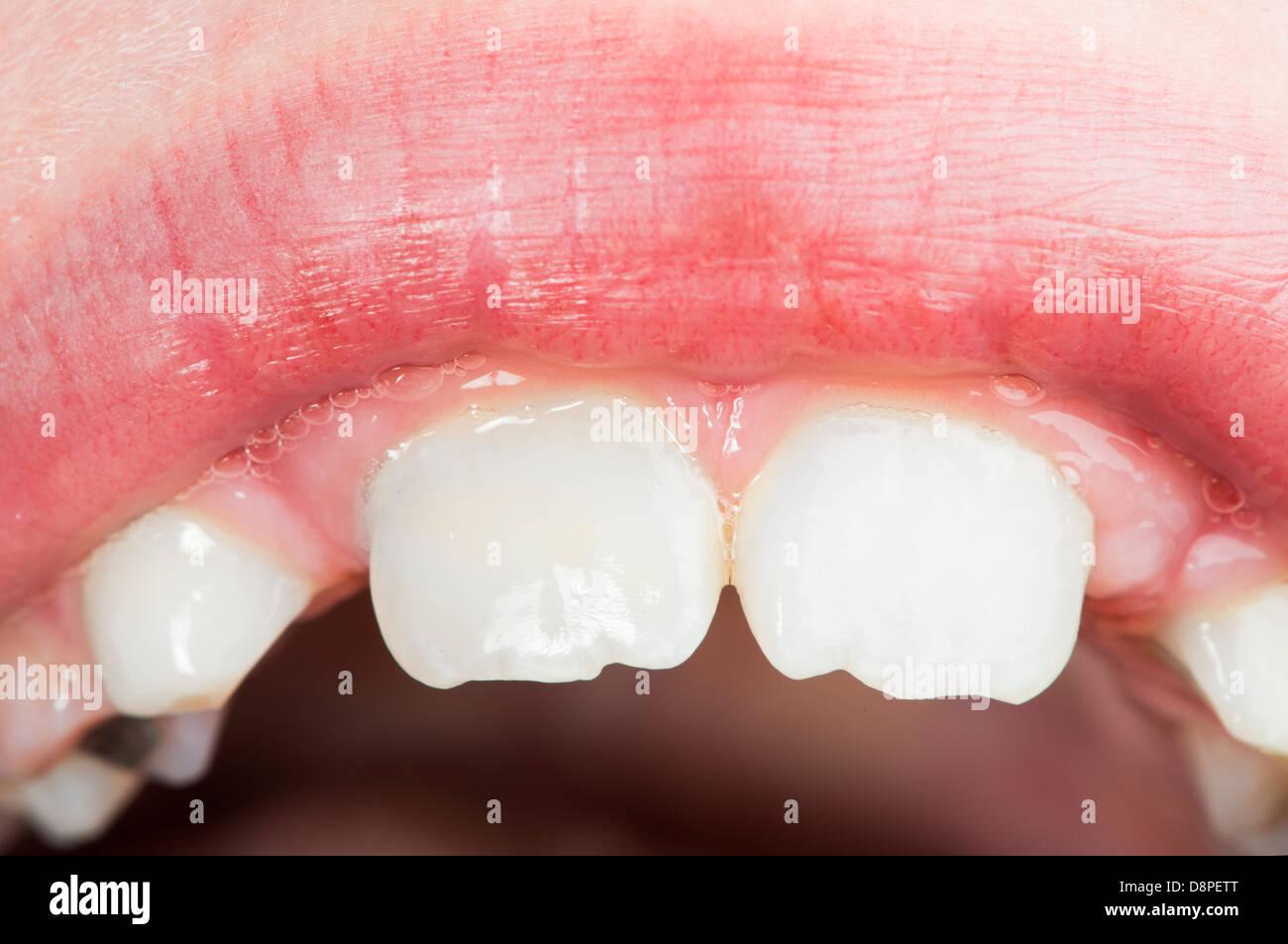 Children's mouth and teeth. Close up studio shot Stock Photo - Alamy