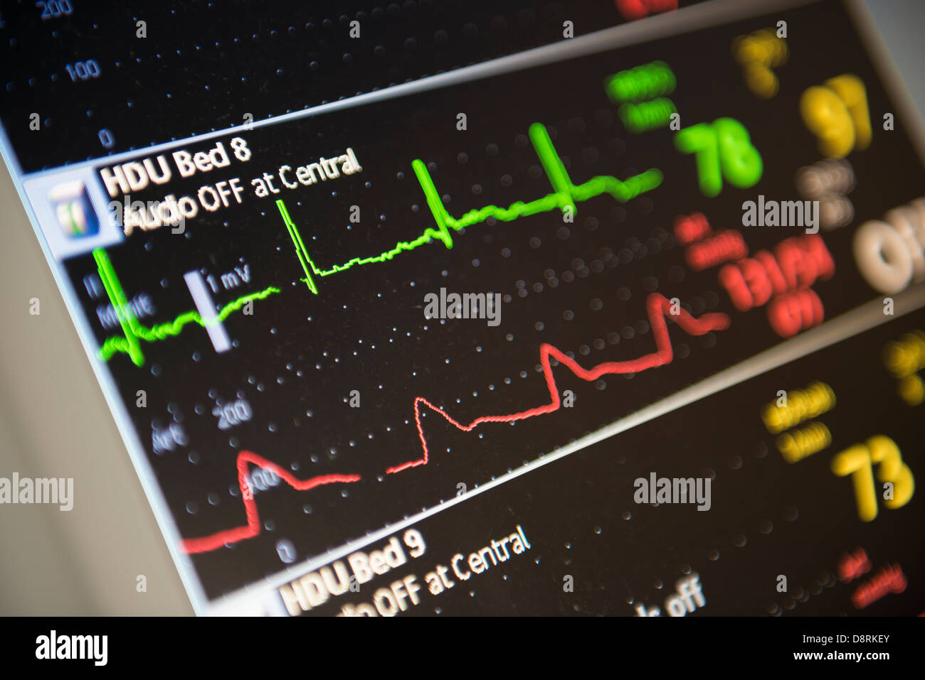 A modern hospital. A high dependency unit monitor Stock Photo - Alamy