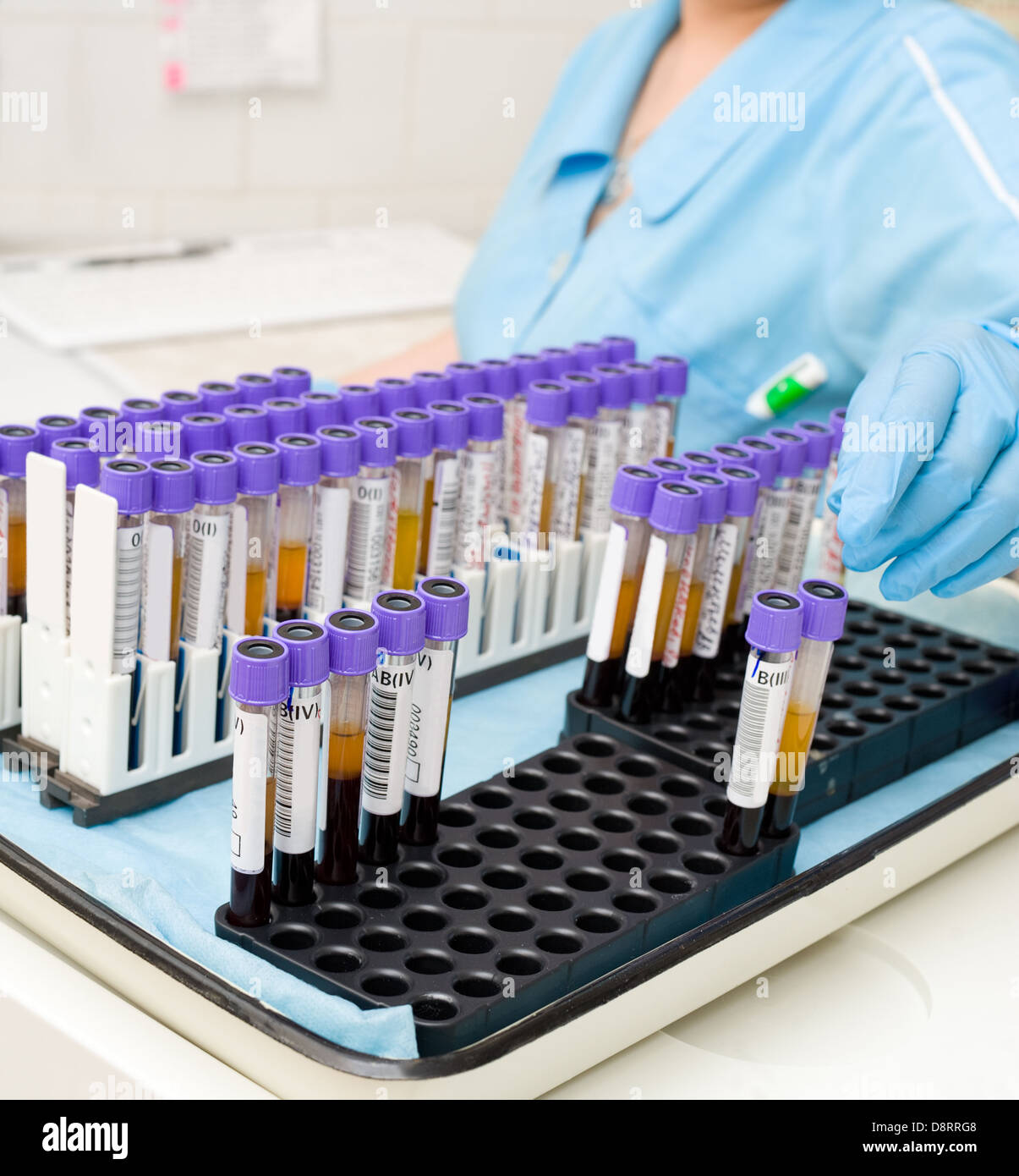 test tubes with blood Stock Photo - Alamy