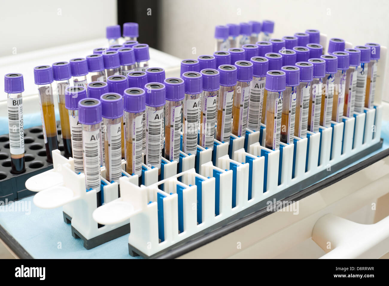 test tubes with blood Stock Photo - Alamy