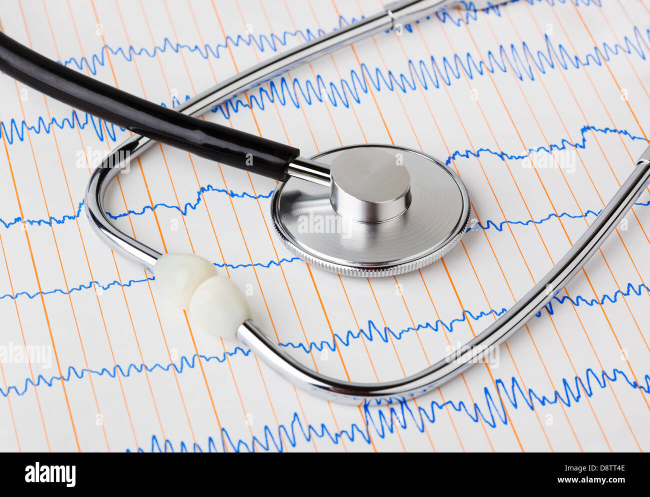 Ecg printout hi-res stock photography and images - Alamy