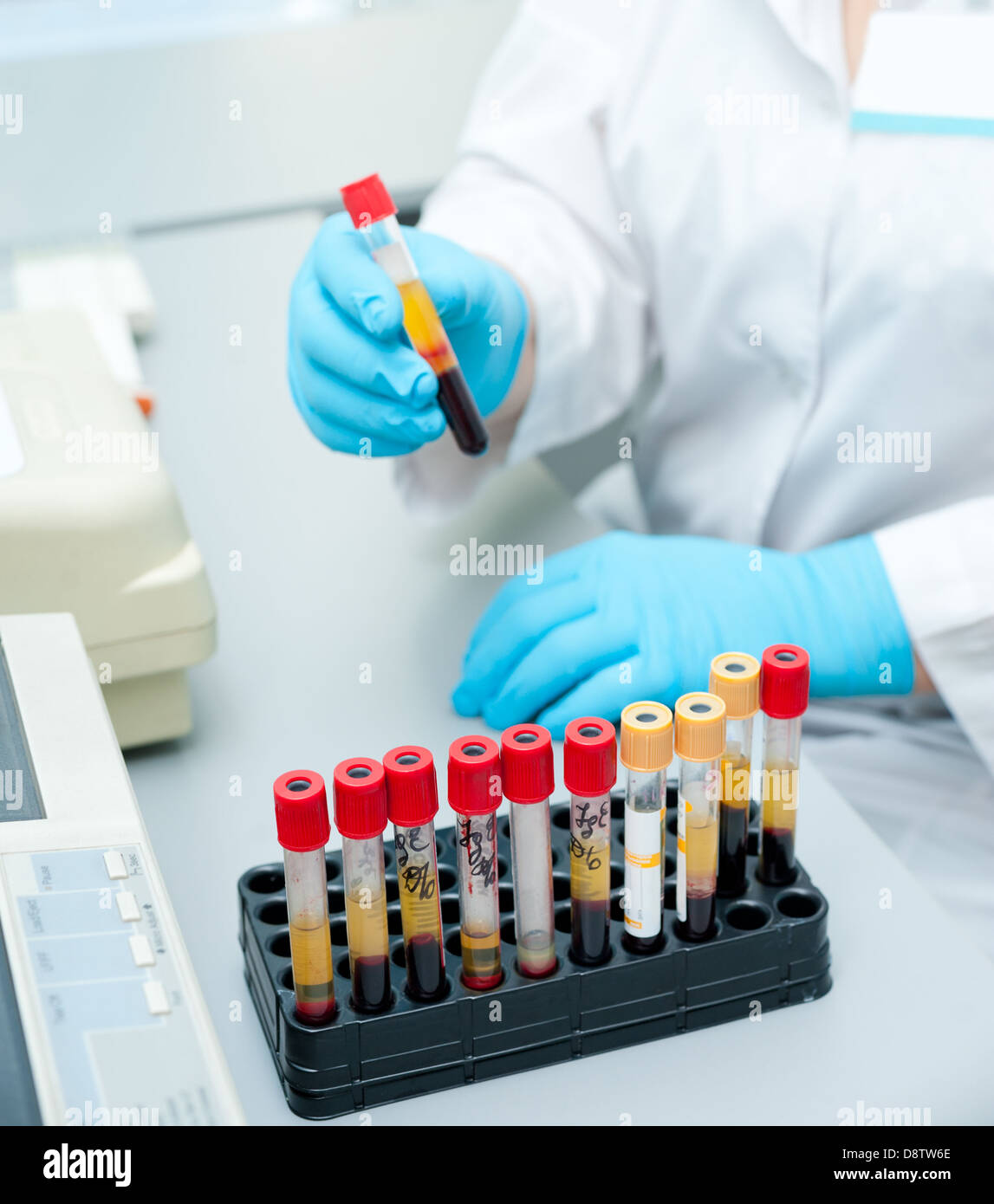 Blood tube sticker hi-res stock photography and images - Alamy