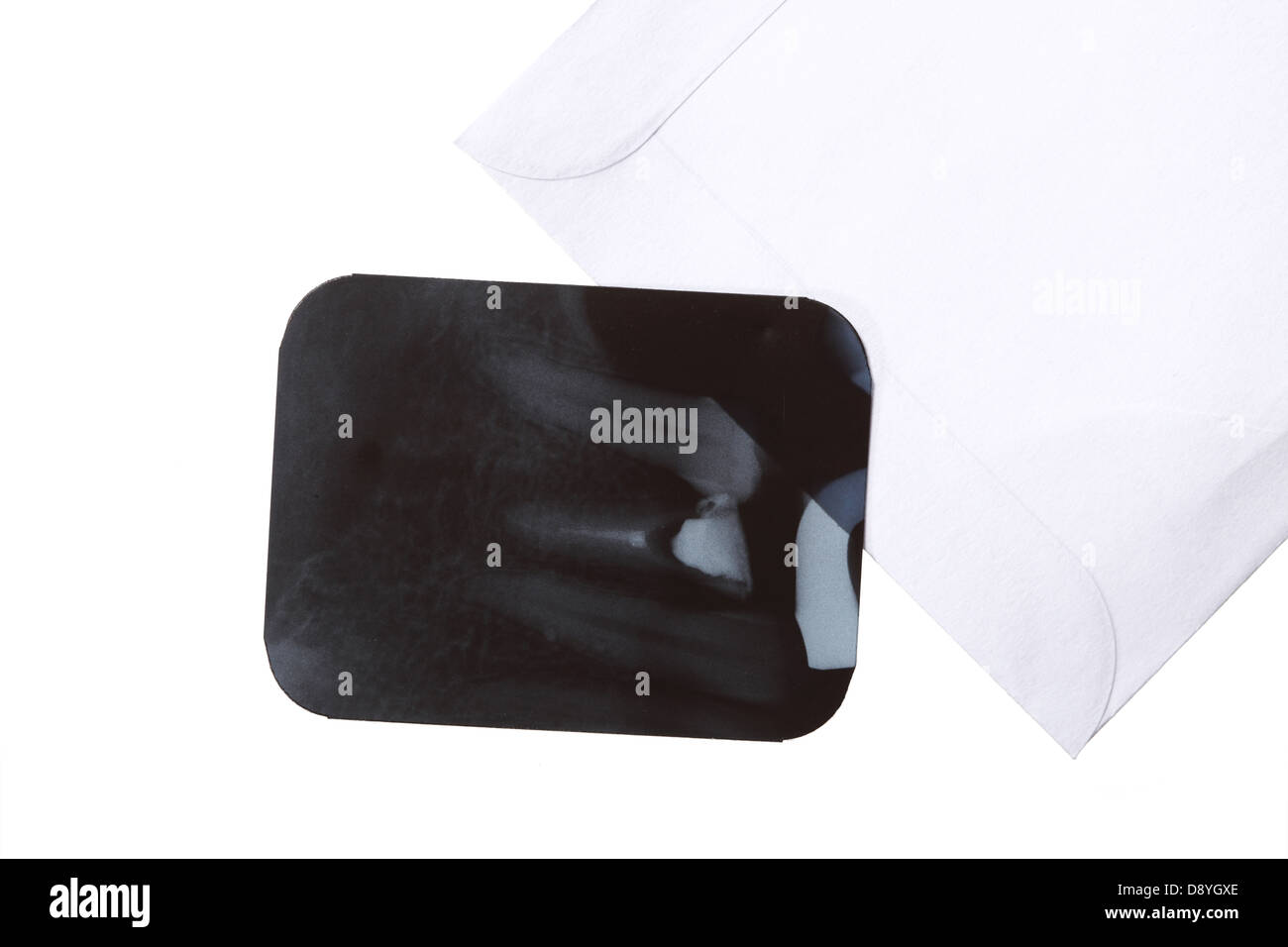 X-ray scan of humans teeth Stock Photo - Alamy