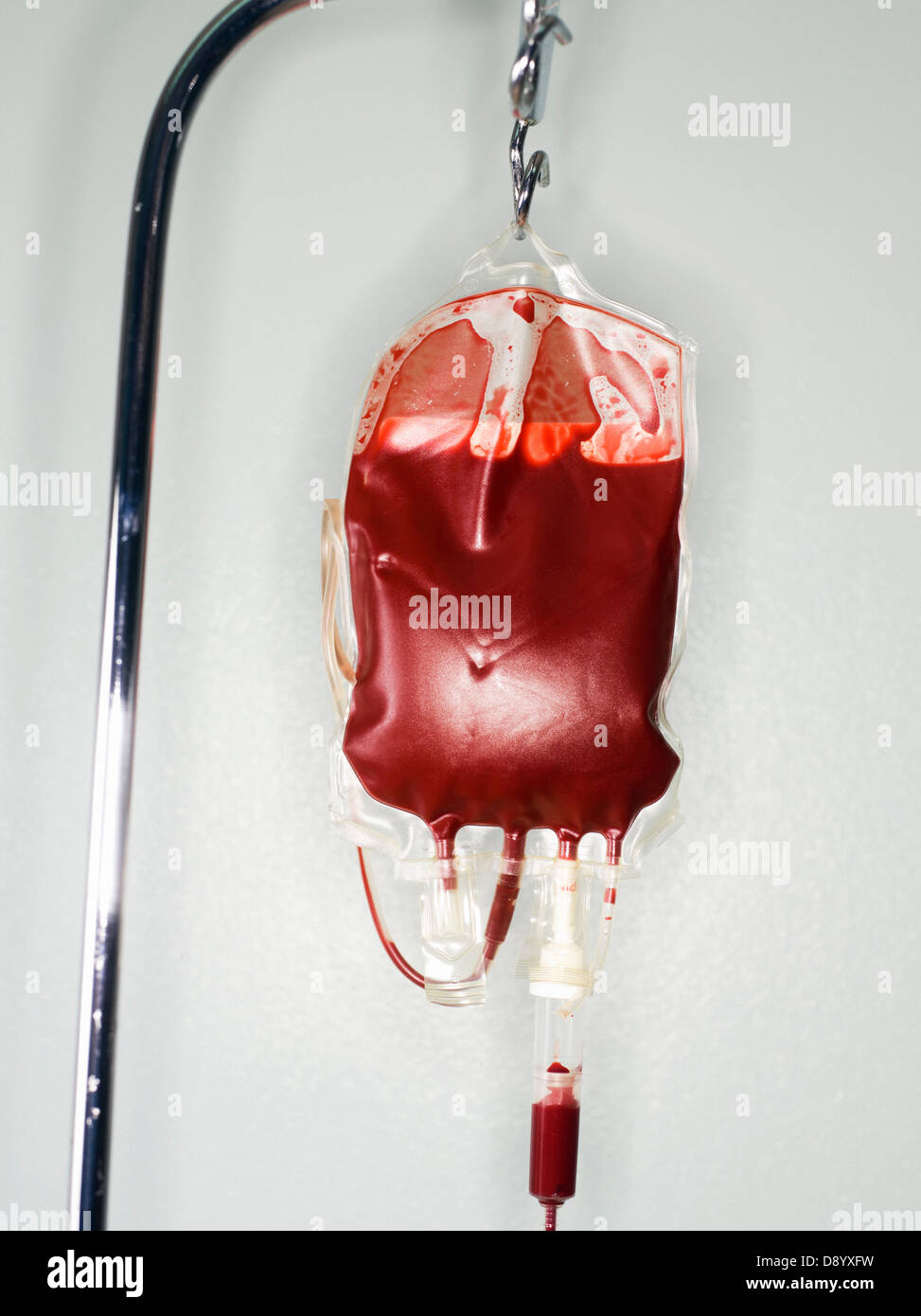 An intravenous drip with blood Stock Photo - Alamy