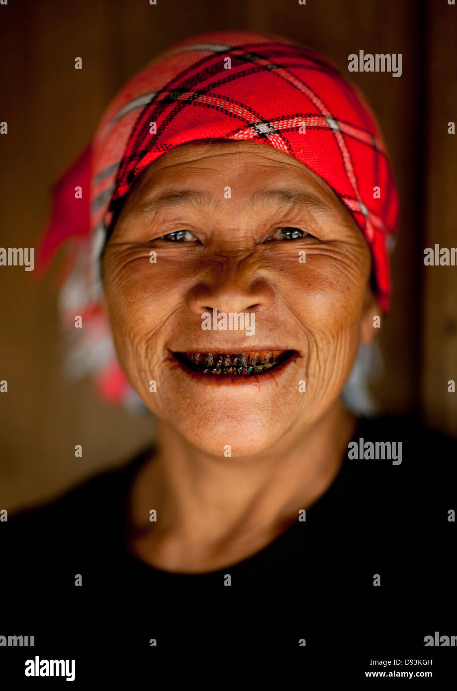 Pygmy Women Teeth