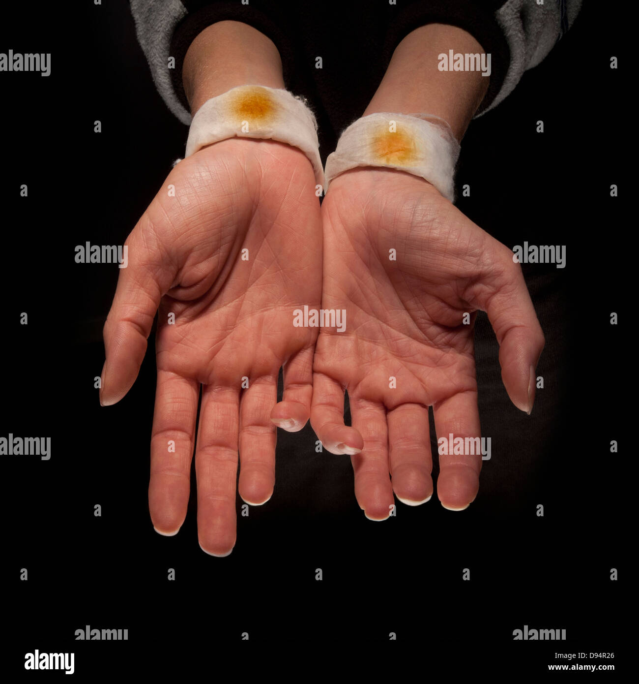 Close-up of Woman's Hands and Stains on Bandaged Wrists, Studio Shot ...